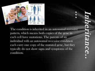 Albinism powerpoint[1] | PPT