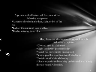 Albinism powerpoint[1] | PPT