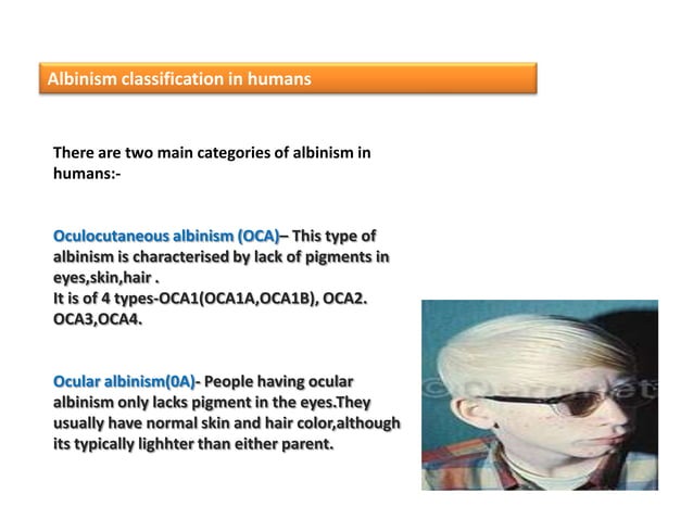 Albinism presantation | PPTX