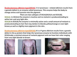 Albinism presantation | PPTX