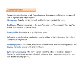 Albinism presantation | PPTX