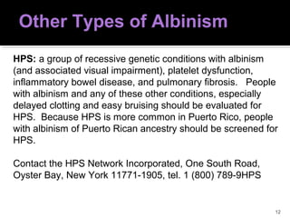 albinism | PPT
