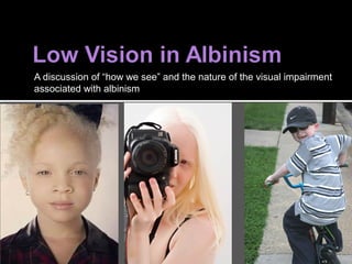 albinism | PPT