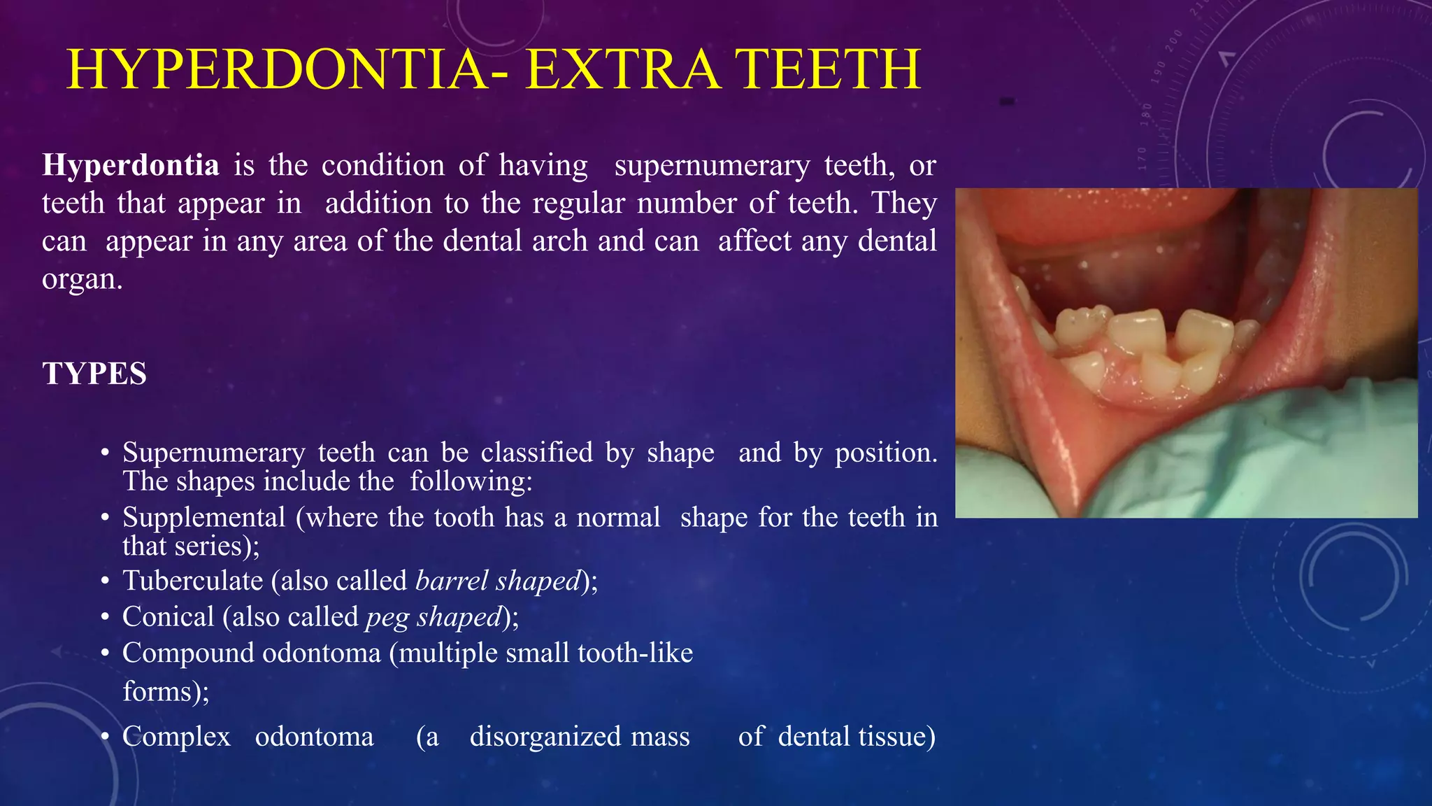 ALBIN TT oralcavity.pptx.pdf