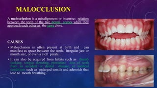 ALBIN TT oralcavity.pptx.pdf