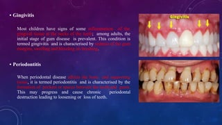 ALBIN TT oralcavity.pptx.pdf