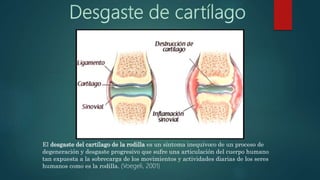 Artrosis de Rodilla | PPTX