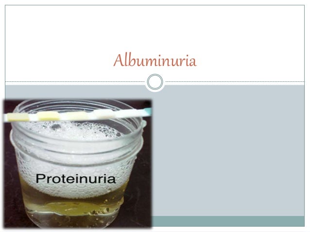 Albuminuria Icd 10
