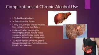 alchohol use disorders psychiatry CLASS.ppt