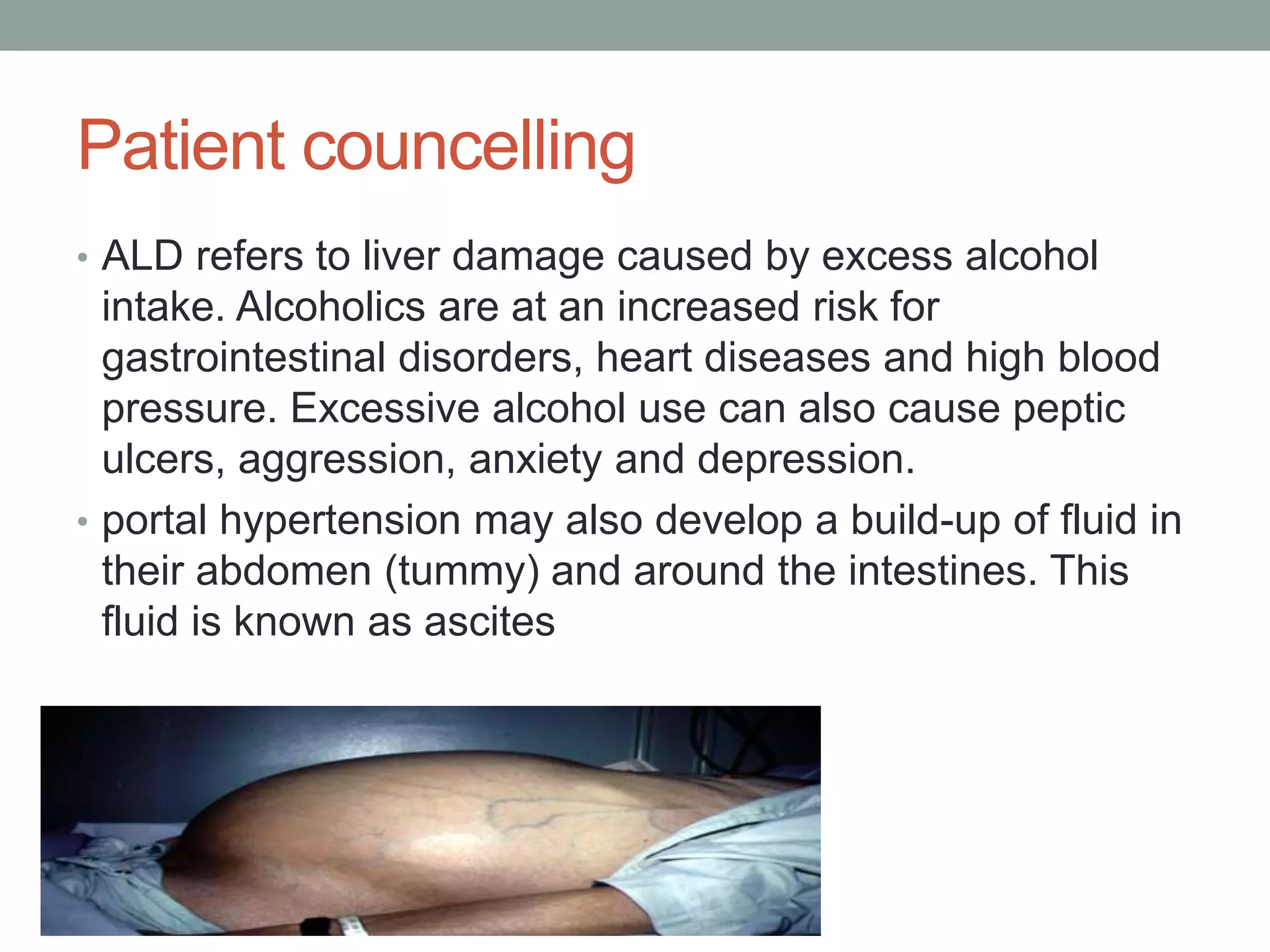 Alcholic liver ascites | PPTX