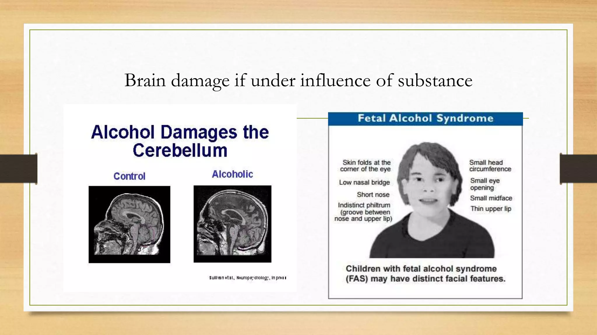 Alcohol abuse presentation | PPTX