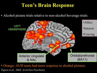 Alcohol & Adolescent Brain Development | PPT