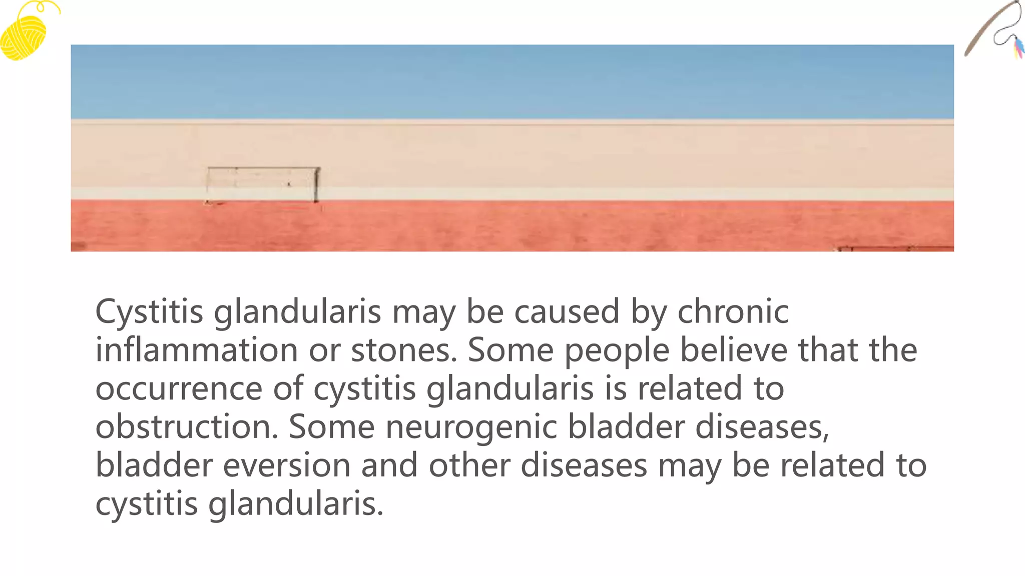 Alcohol Consumption and Cystitis Glandularis: Is it Safe.pptx