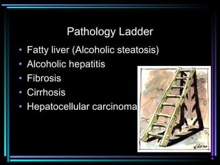Alcoholic Liver Disease | PPT | Digestive Disorders | Diseases and ...