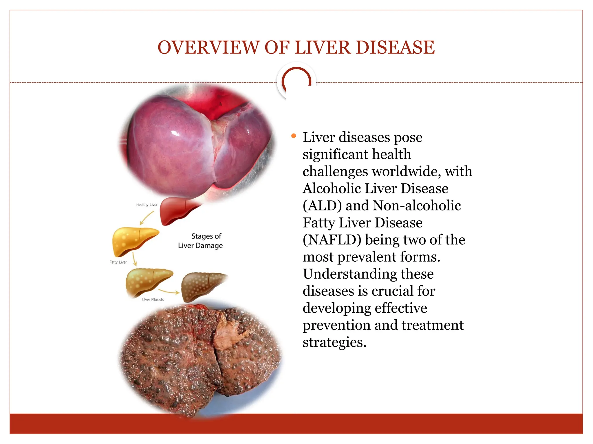 ALCOHOLIC AND NON-ALCOHOLIC FATTY LIVER DISEASES.pptx