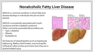 Alcoholic And Nonalcoholic Fatty Liver Disease.pptx