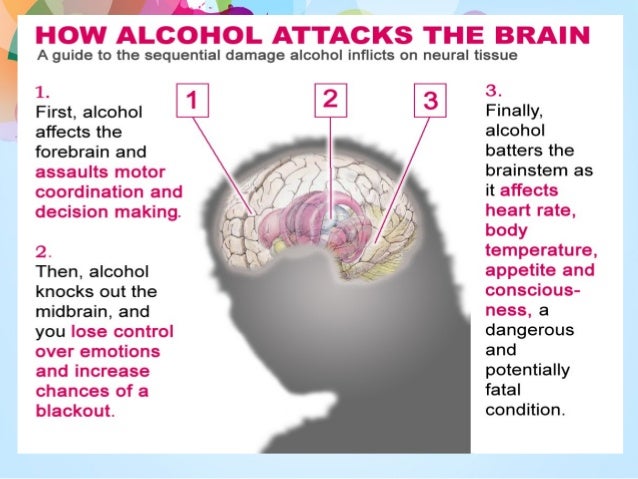 Alcoholic brain