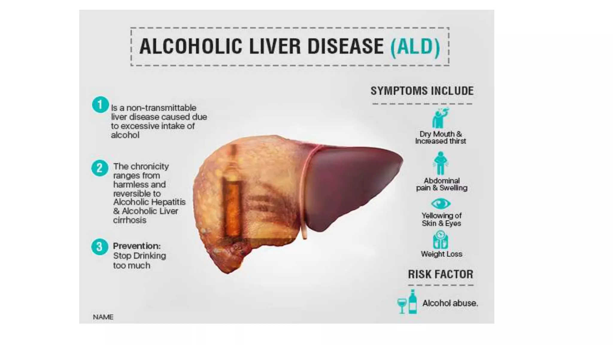 Alcoholic Liver Disease (3).pptx