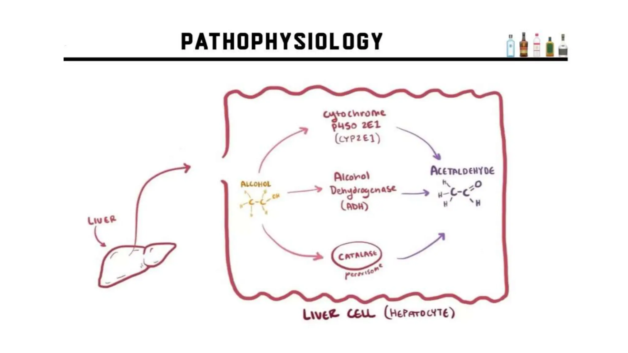 ALCOHOLIC LIVER DISEASE. By Dr. fatima nasir FMC jabi | PPT