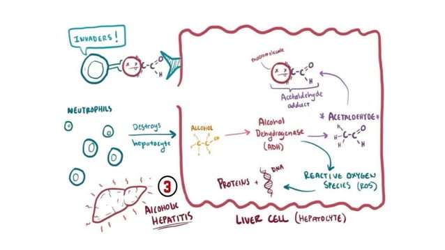 ALCOHOLIC LIVER DISEASE. By Dr. fatima nasir FMC jabi | PPT