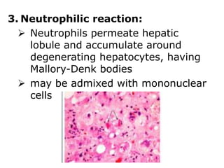 Alcoholic liver disease mbbs | PPTX