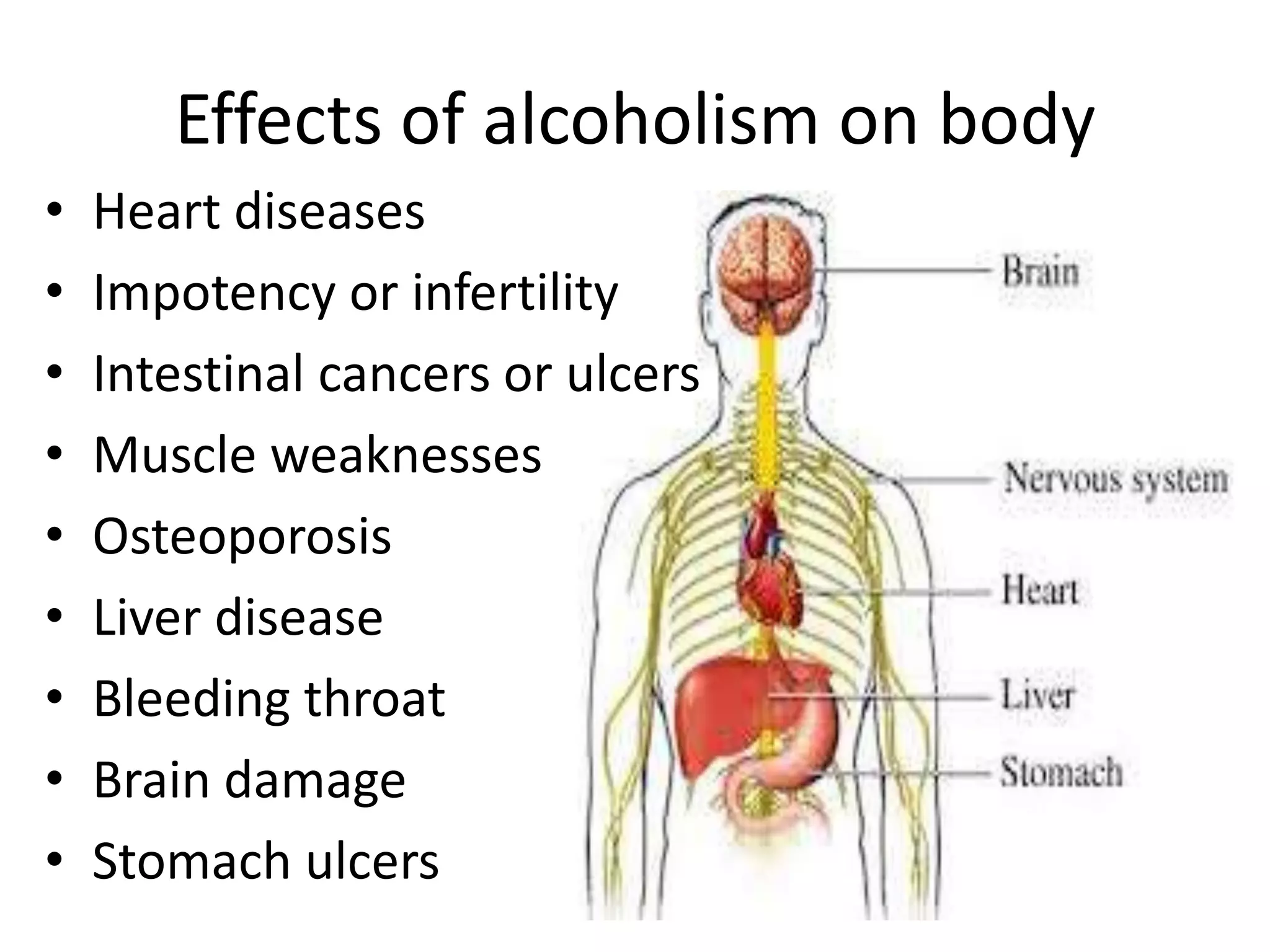 Alcoholism | PPTX