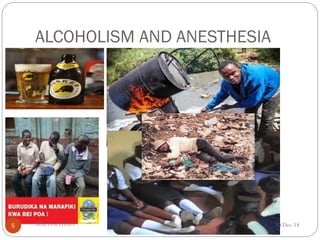ALCOHOLISM AND ANESTHESIA. ANESTHESIA CONSIDERATIONS | PDF