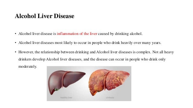 Alcohol liver disease.pptx