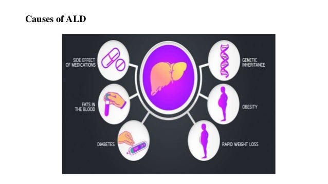 Alcohol liver disease.pptx