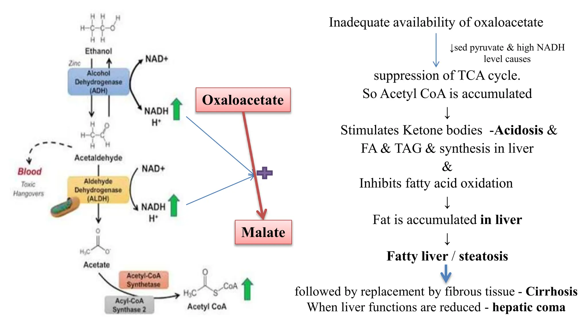 Alcohol metabolism and alcoholism & Fatty liver.pptx