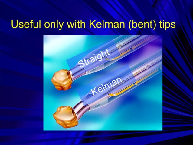 Alcon innovations | PPT