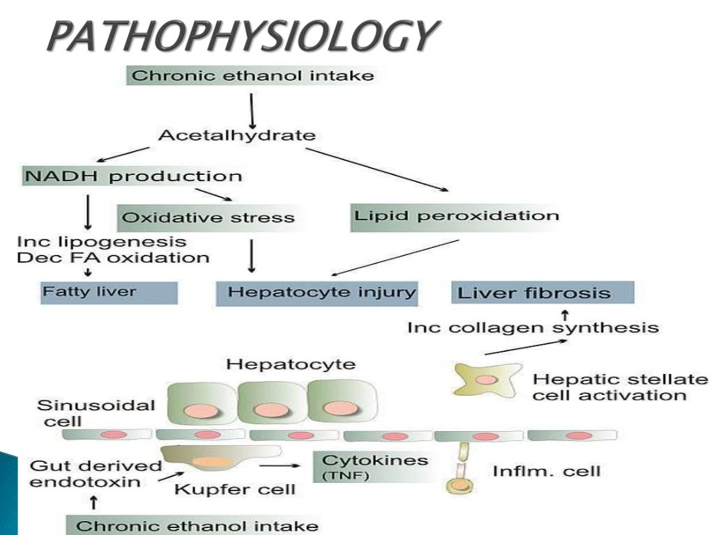Alcoholic Liver Disease
