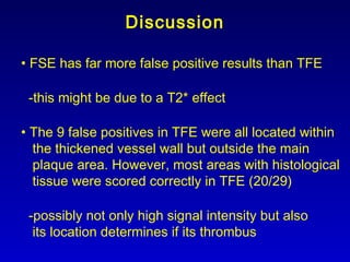 In vivo mri of thrombi in advanced atherosclerosis | PPT