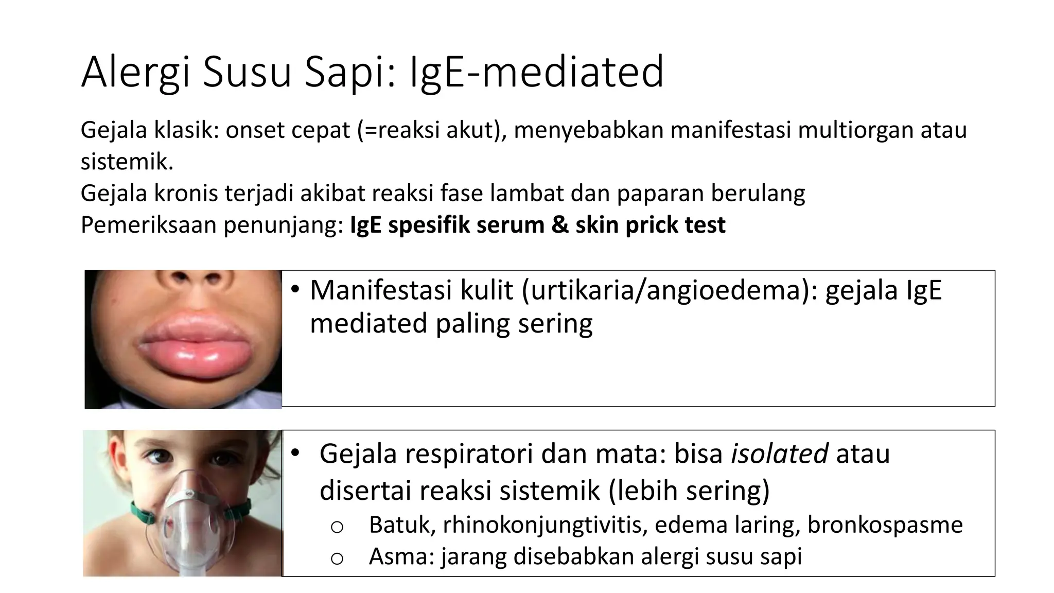 Alergi Susu Sapi - Dr. dr. Endah C. Sp.A (K).pptx