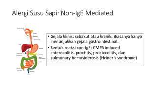 Alergi Susu Sapi - Dr. dr. Endah C. Sp.A (K).pptx