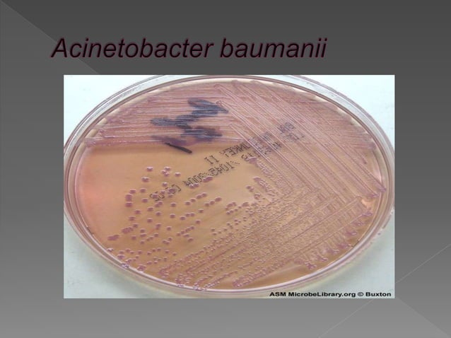 ALERT ORGANISM SURVEILLANCE.pptx