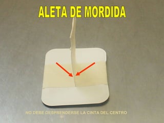 radiografia Aleta y oclusal | PPT
