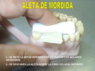 radiografia Aleta y oclusal | PPT