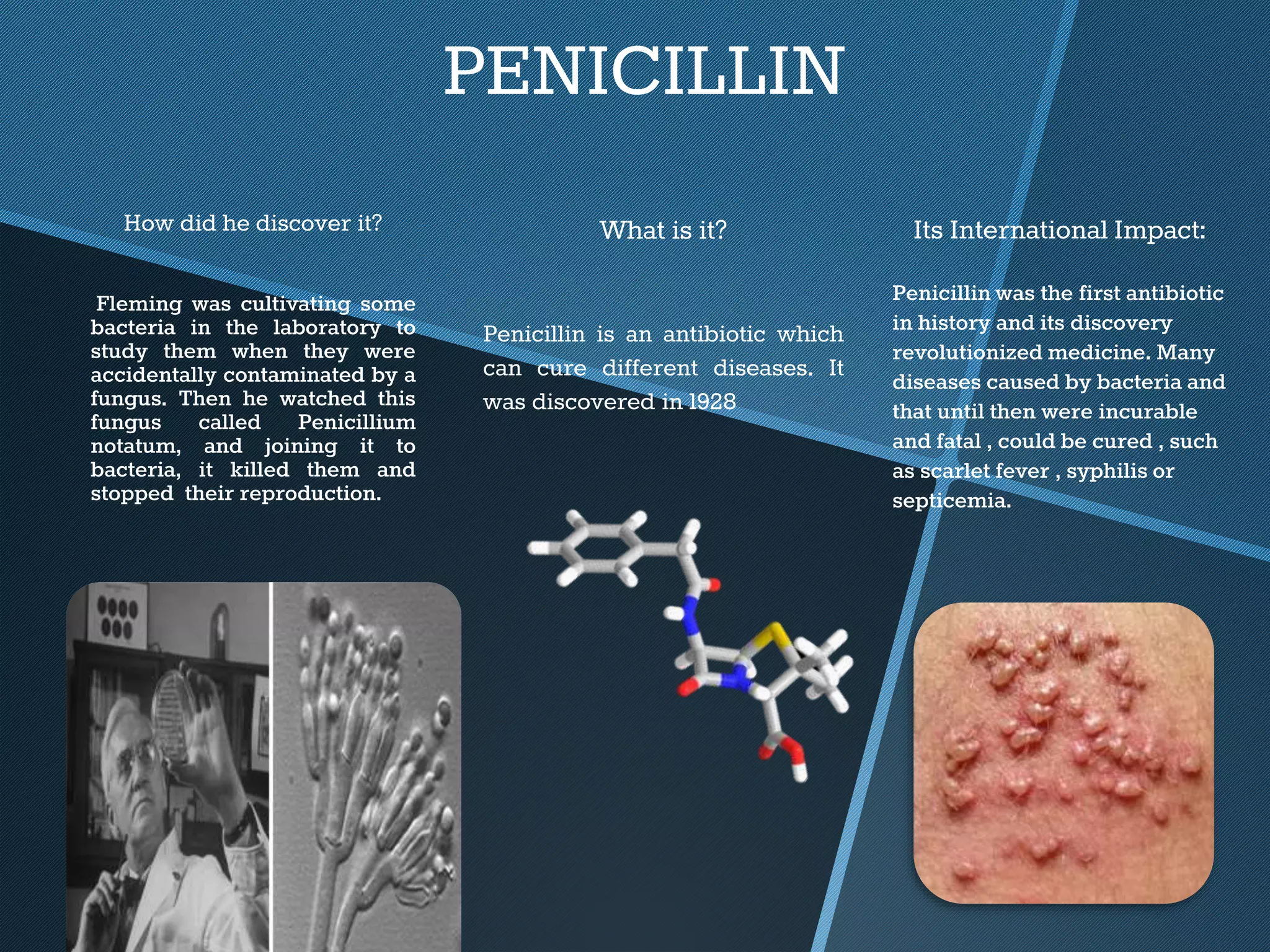 Alexander Fleming.ppt