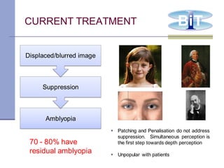 Assessment and Treatment of patients with Amblyopia using interactive ...