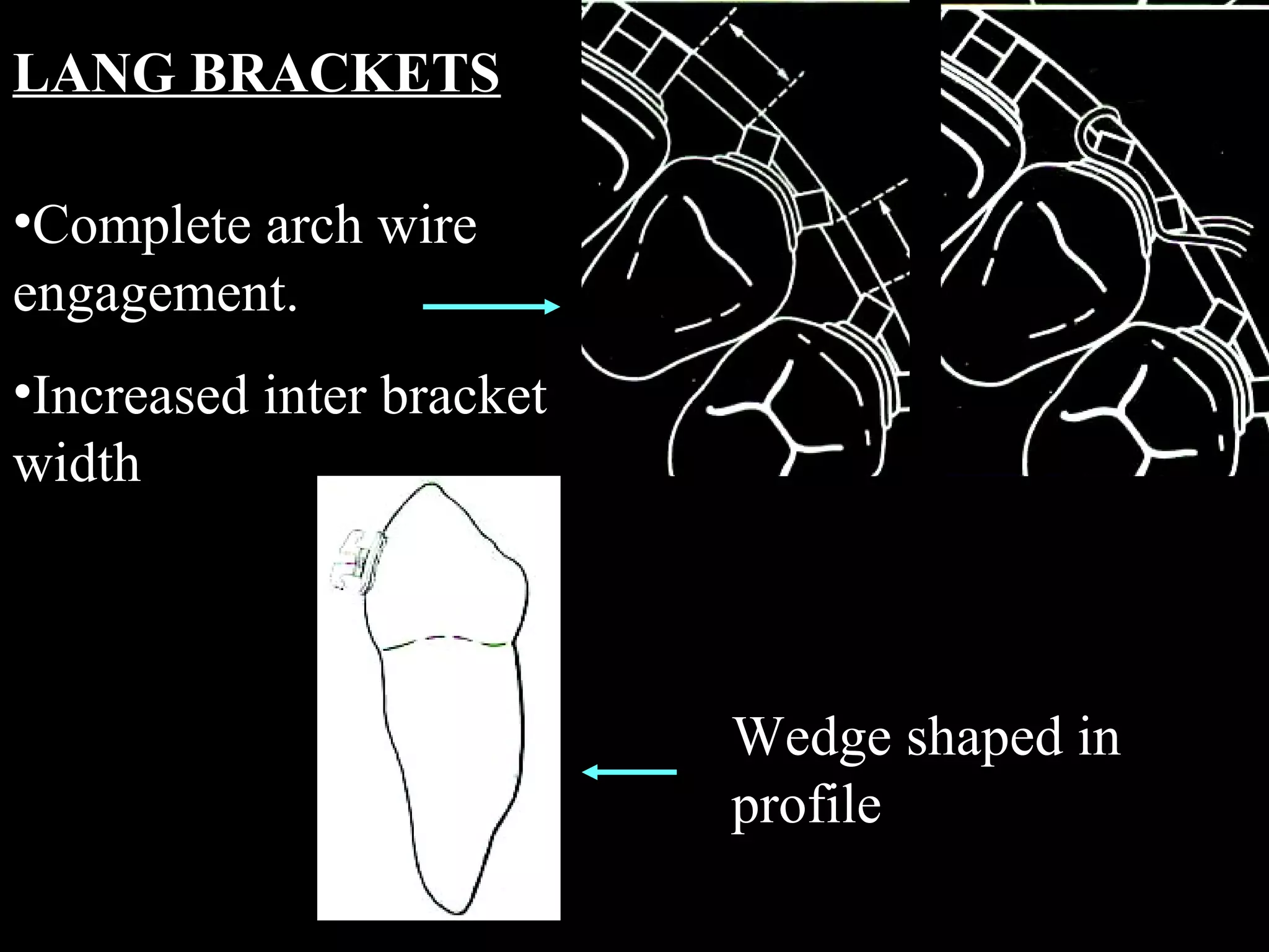 Alexanders vari simplex discipline | PPT | Dental Health | Diseases and ...