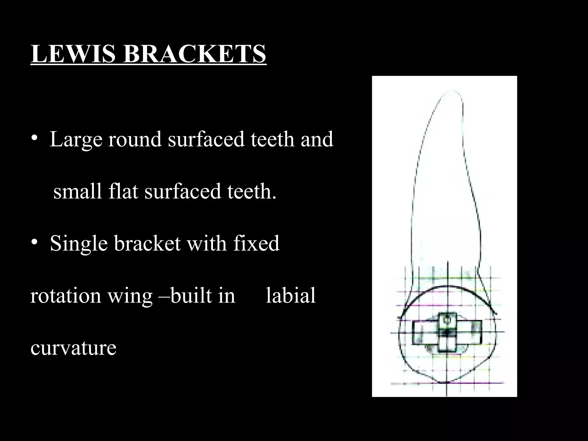 Alexanders vari simplex discipline | PPT