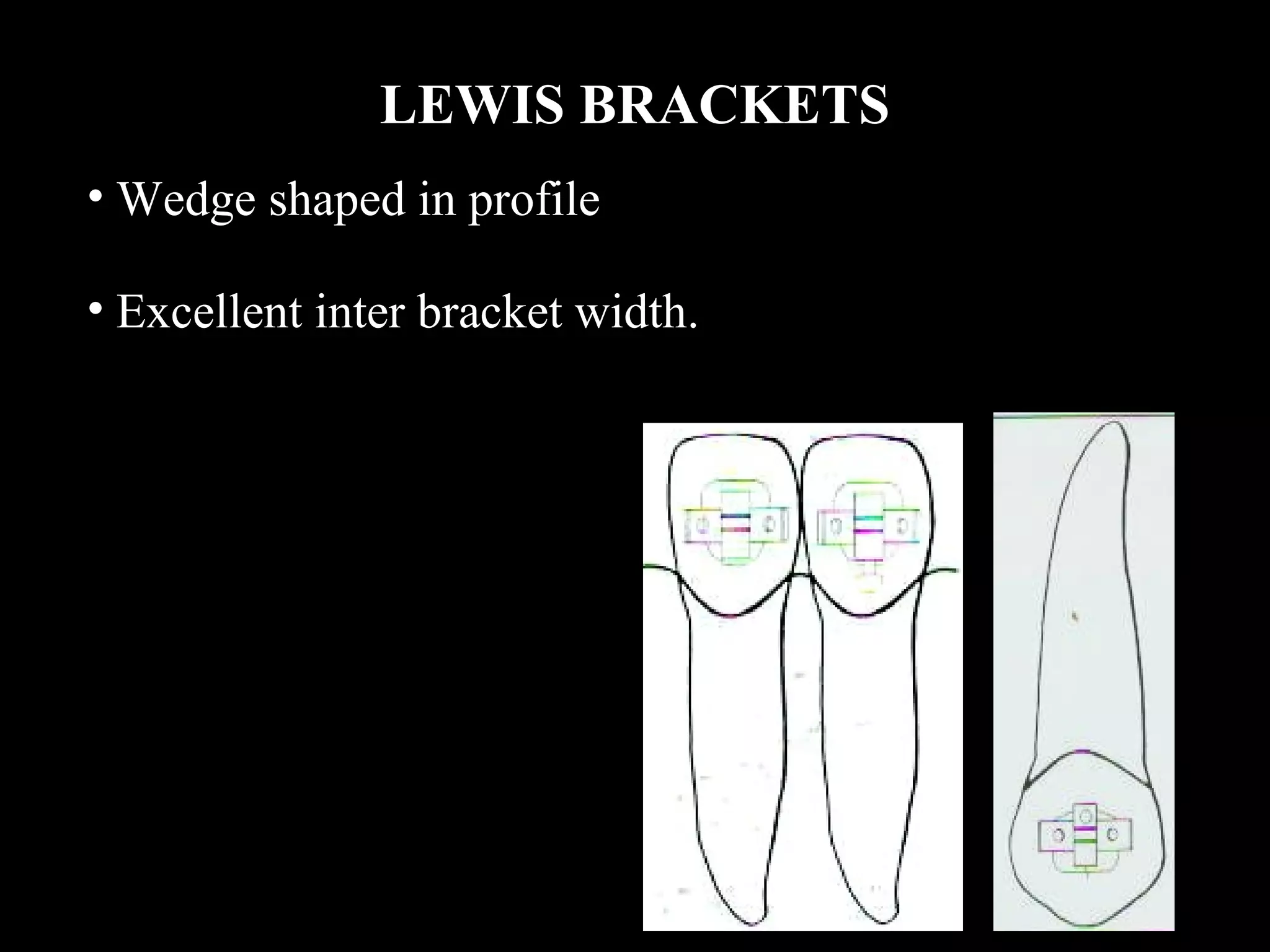 Alexanders vari simplex discipline | PPT