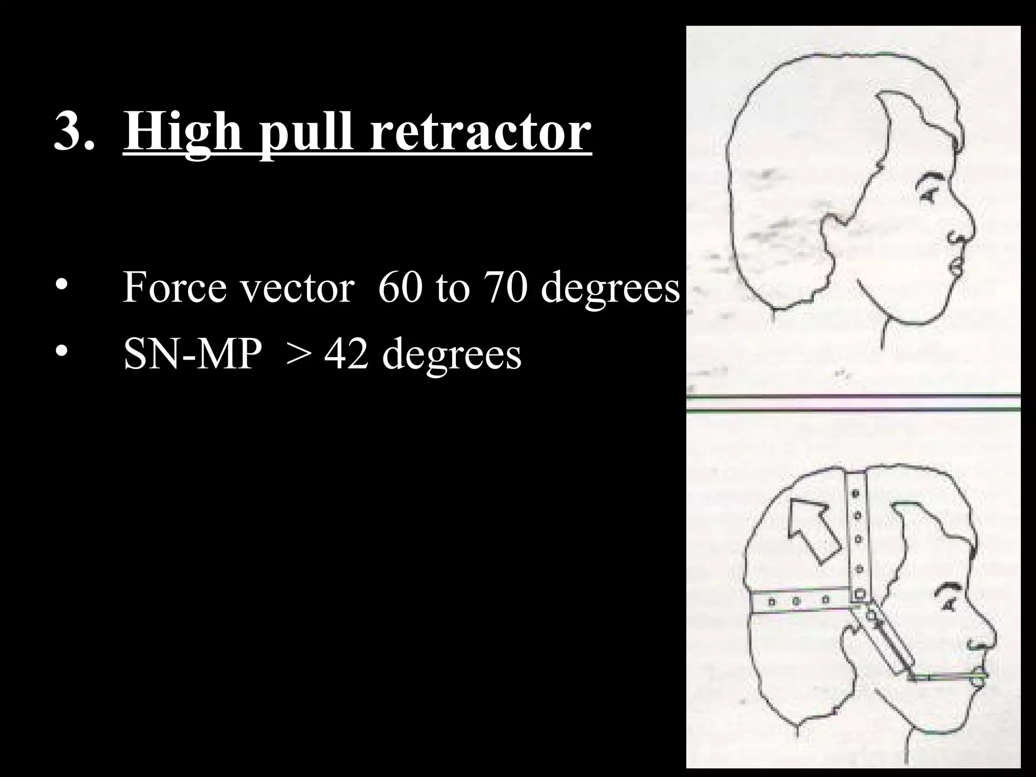 Alexanders vari simplex discipline | PPT | Dental Health | Diseases and ...