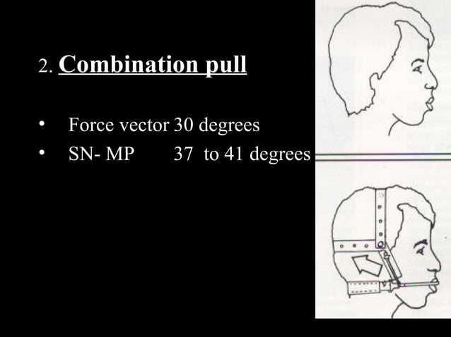 Alexanders vari simplex discipline | PPT | Dental Health | Diseases and ...
