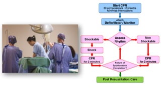 Vortex Approach to Unexpected Difficult Airway | PDF