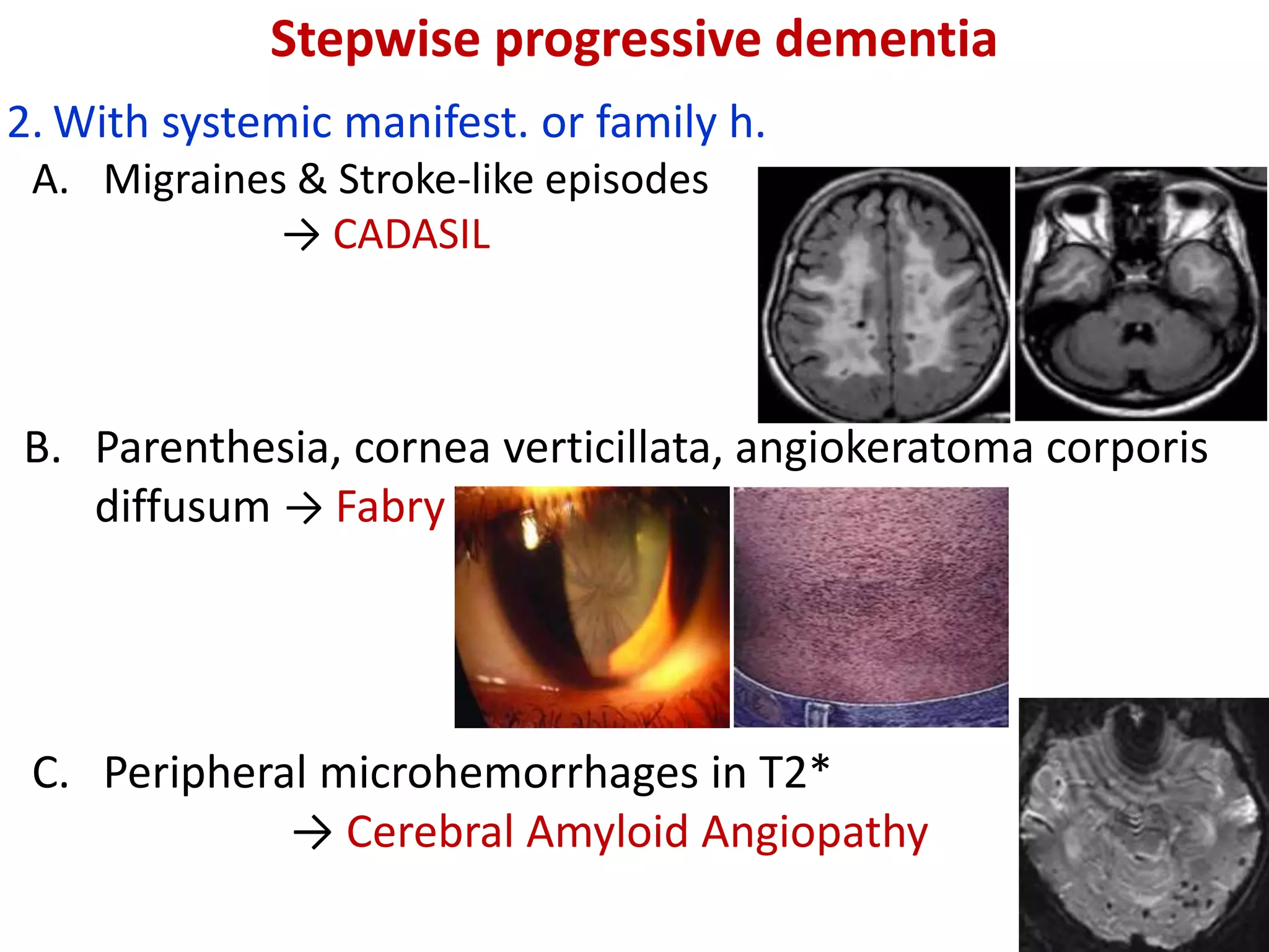Algorithm for dementia for postgraduates | PPT