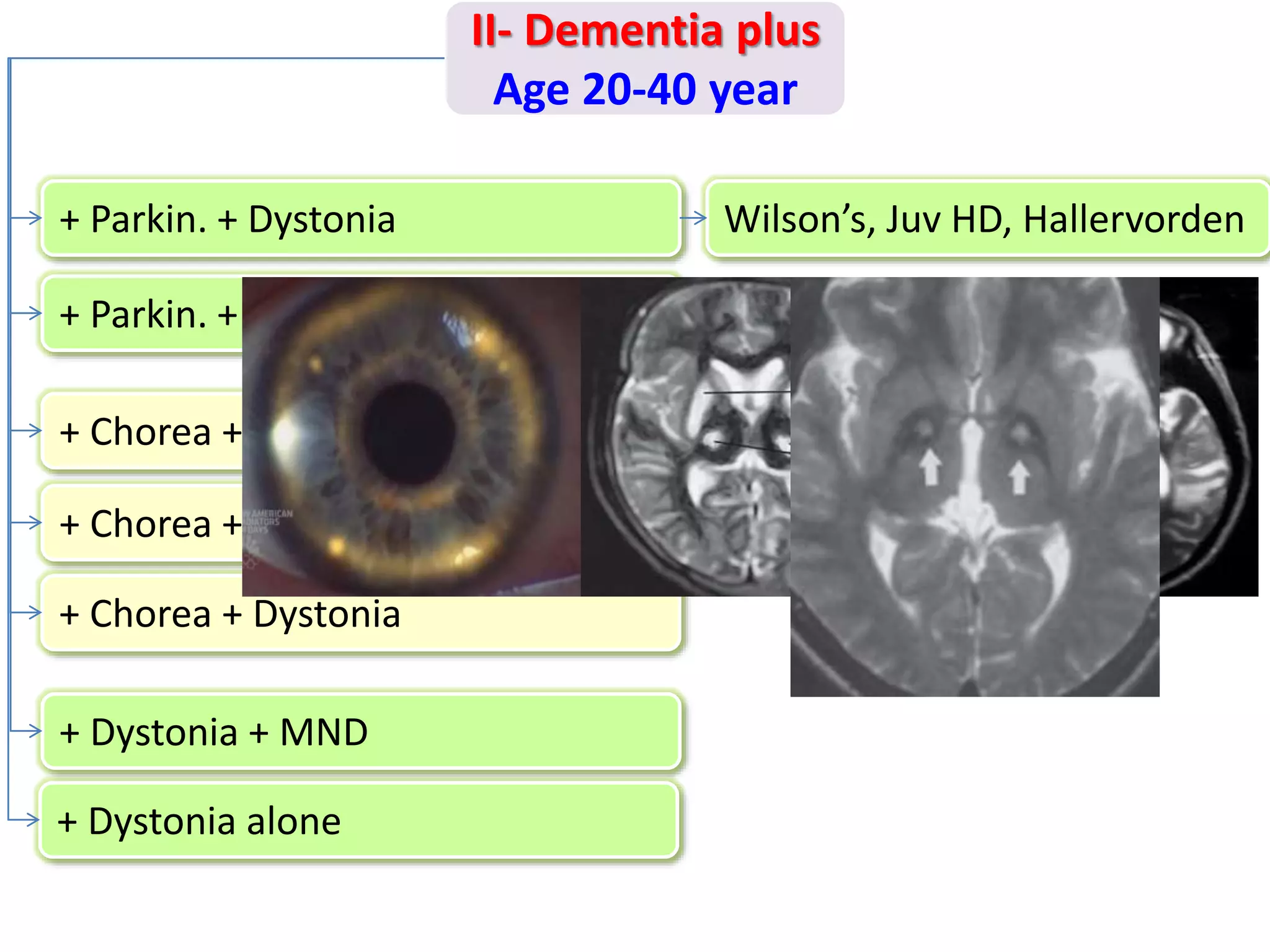 Algorithm for dementia for postgraduates | PPT
