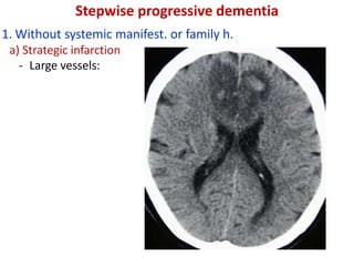 Algorithm for dementia for postgraduates | PPT