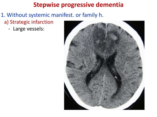 Algorithm for dementia for postgraduates | PPT